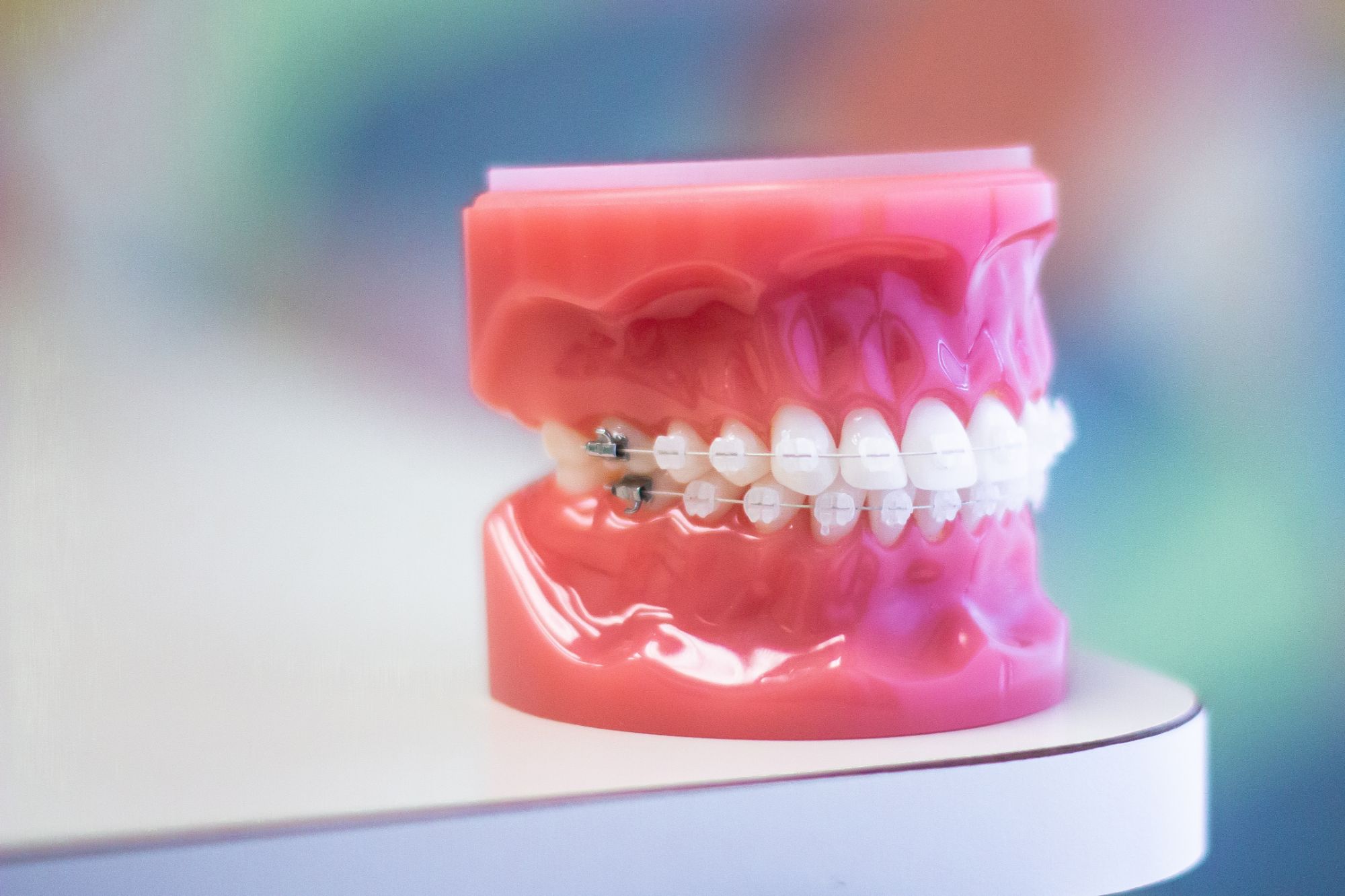 Clear Braces | McDermott Orthodontics | Family Orthodontist